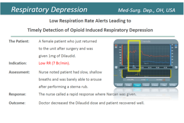 EarlySense - Physician-Patient Alliance for Health & Safety